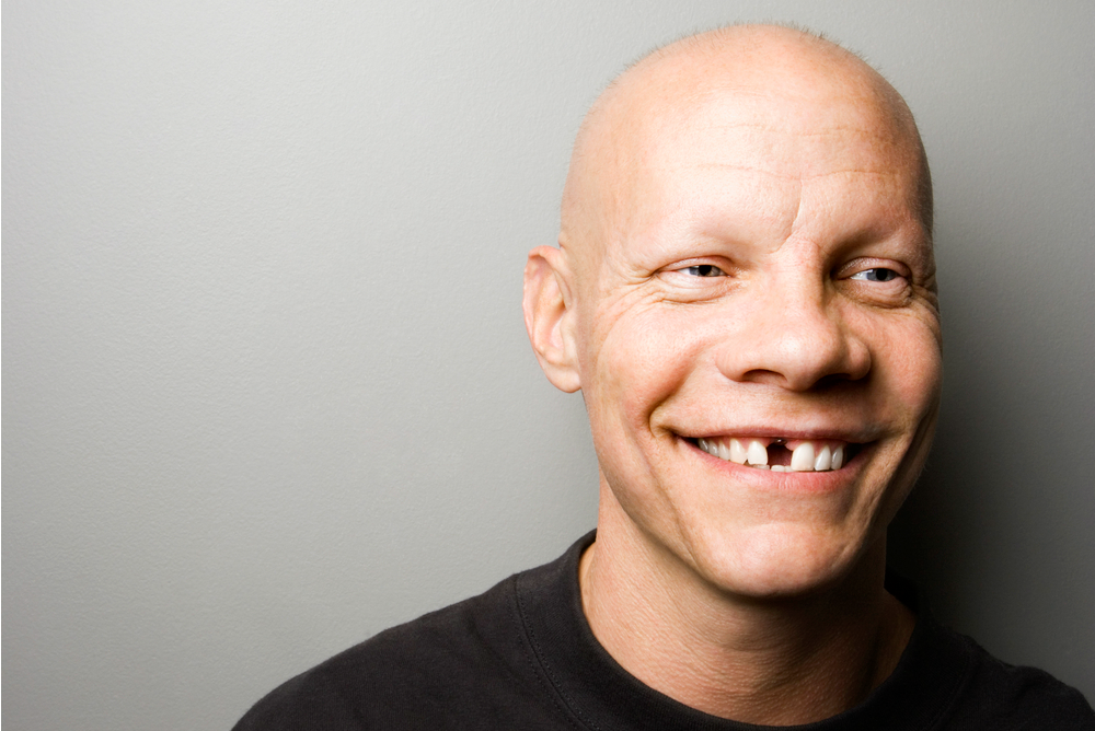 5 Risks of Not Replacing Missing Teeth